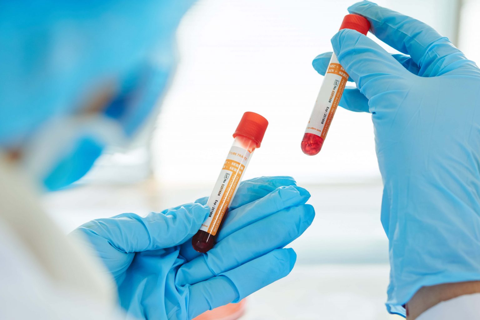 Tipos de Estudio de Sangre: Tu Guía para la Salud | VRIM